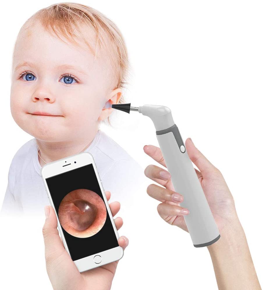 Wireless Otoscope: Ear Cleaning Camera with Ear Cleaning Kit – ScopeAround